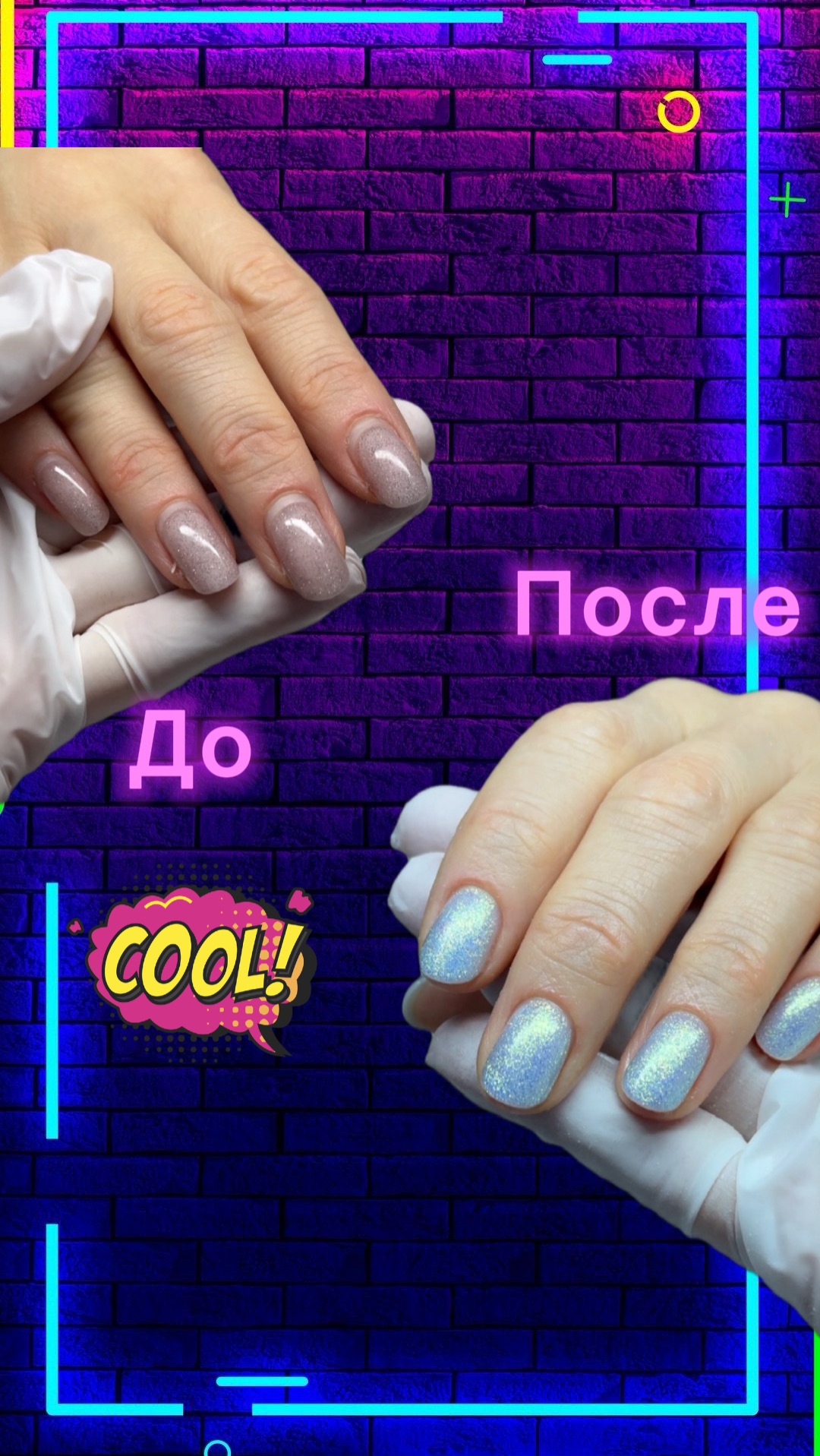 Коррекция ногтей до и после