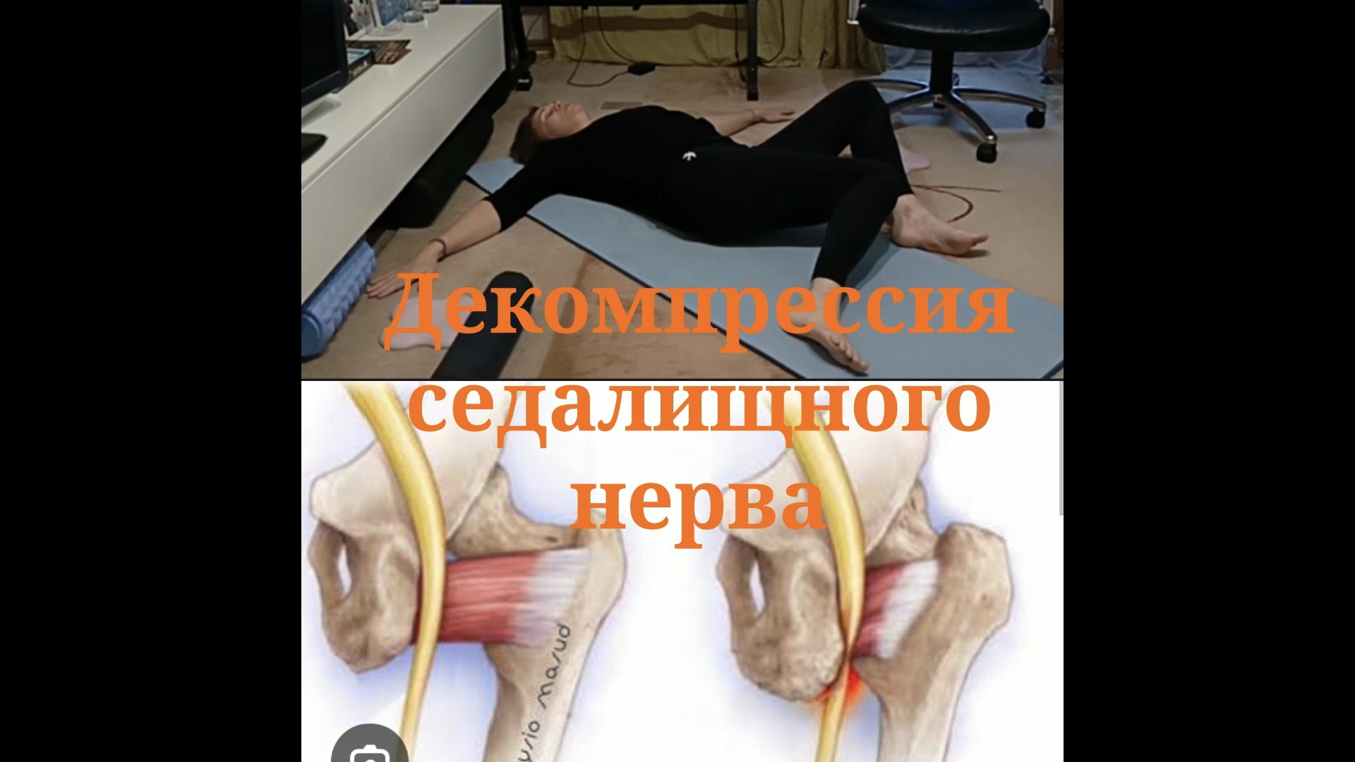Освобождаем седалищный нерв упражнениями.