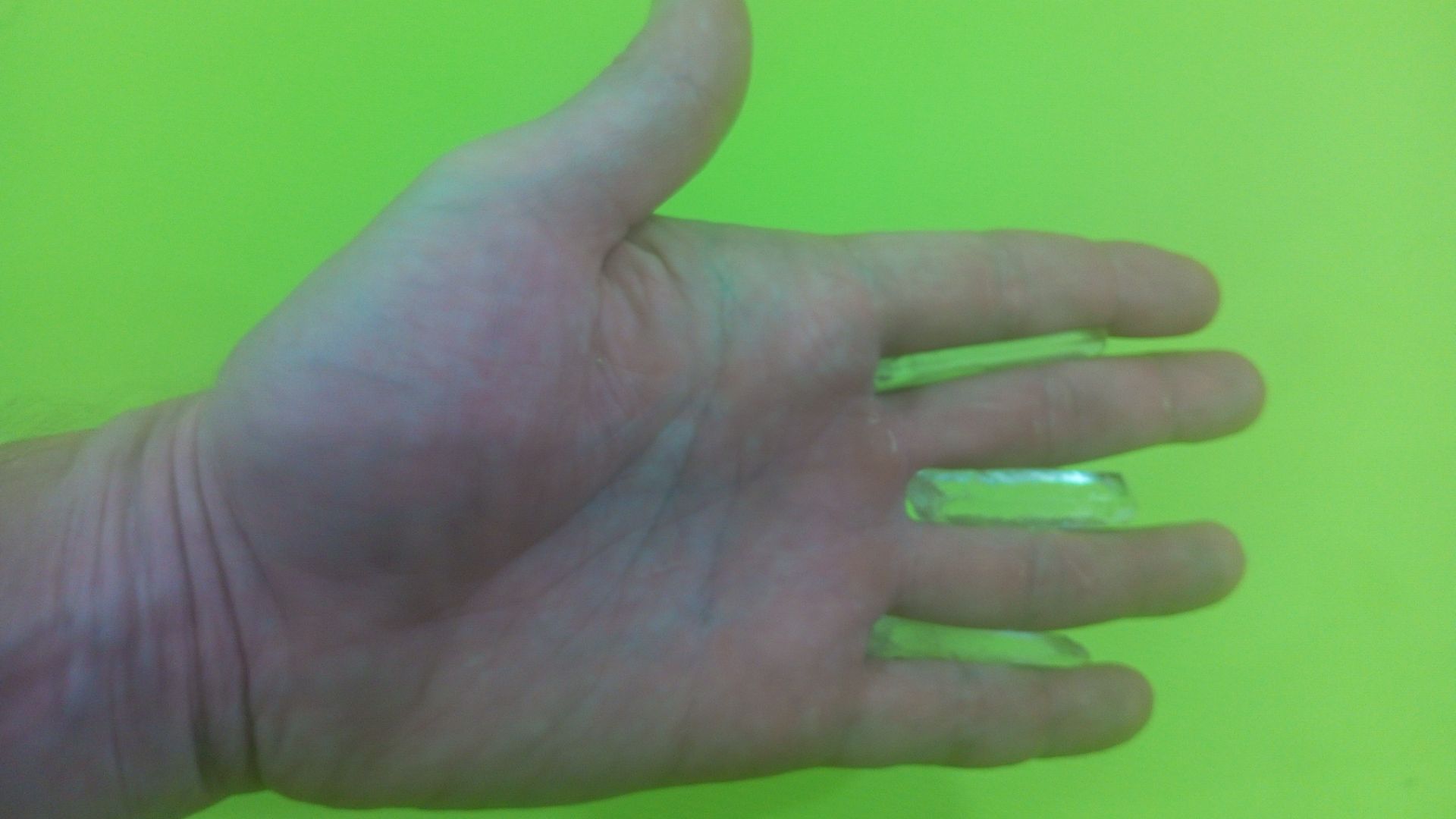 Кристаллы кварца между фалангами пальцев