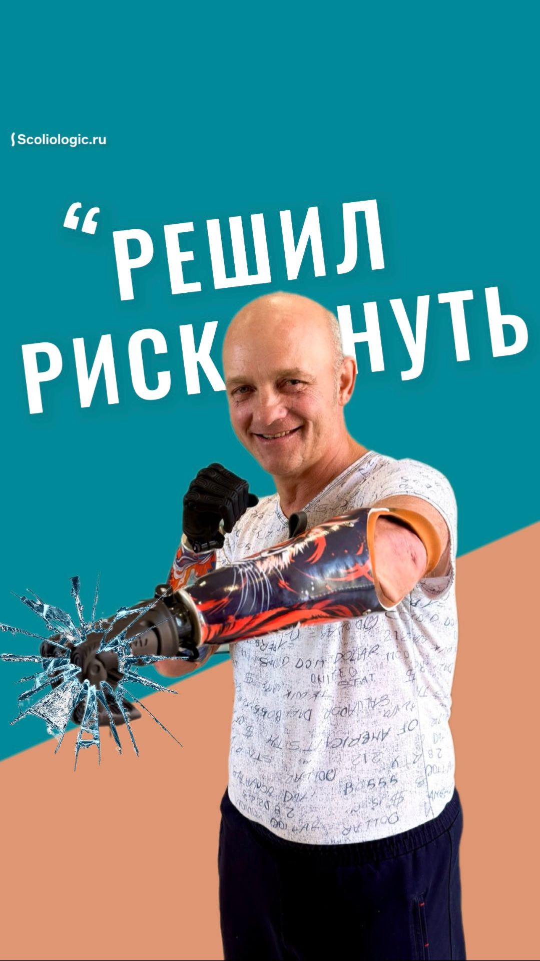 Потерял обе руки после минно-взрывной травмы