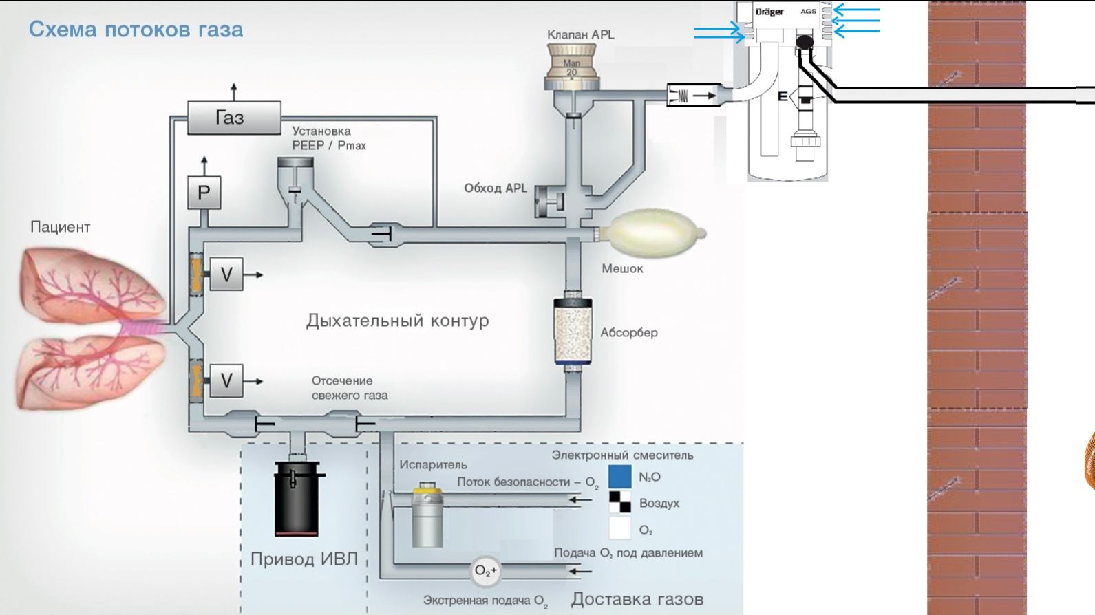 AGSS система удаления анестезирующих газов