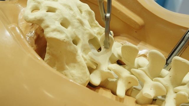 BIOPROM Talks. Сослан Торчинов, врач-нейрохирург