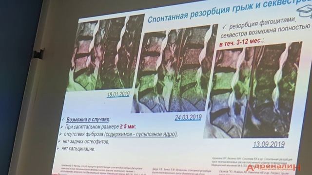 МРТ. Как смотреть и оценивать.