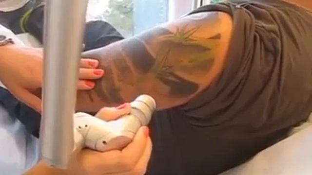 Сводят наколки вот так