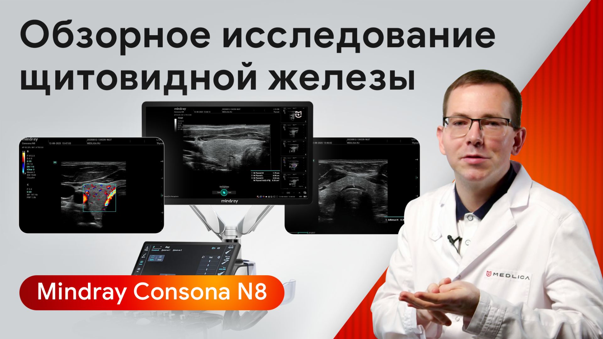 Разбор возможностей Mindray Consona N8: УЗИ щитовидной железы