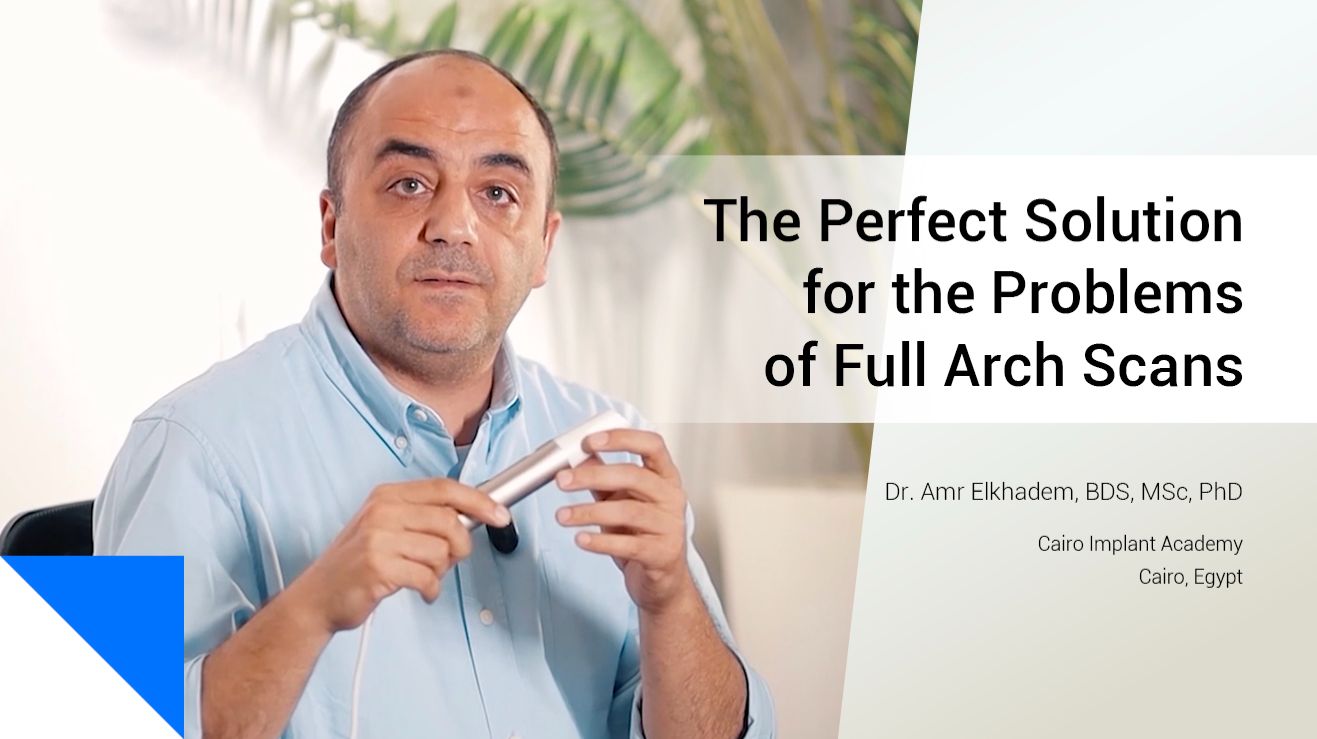 Отзыв о сканере Aoralscan Elite от доктора из Египта Амр Эльхадем