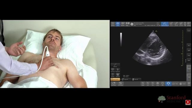 4 Common Mistakes in Point of Care Cardiac Ultrasound Stanford  рус