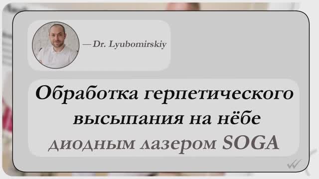 Обработка герпетического высыпания на нёбе диодным лазером SOGA с Геннадием Любомирским