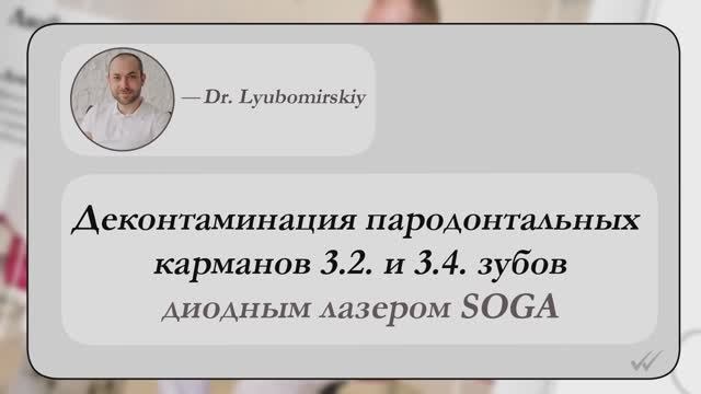 Деконтаминация пародонтальных карманов зубов 3.2 и 3.4 диодным лазером SOGA