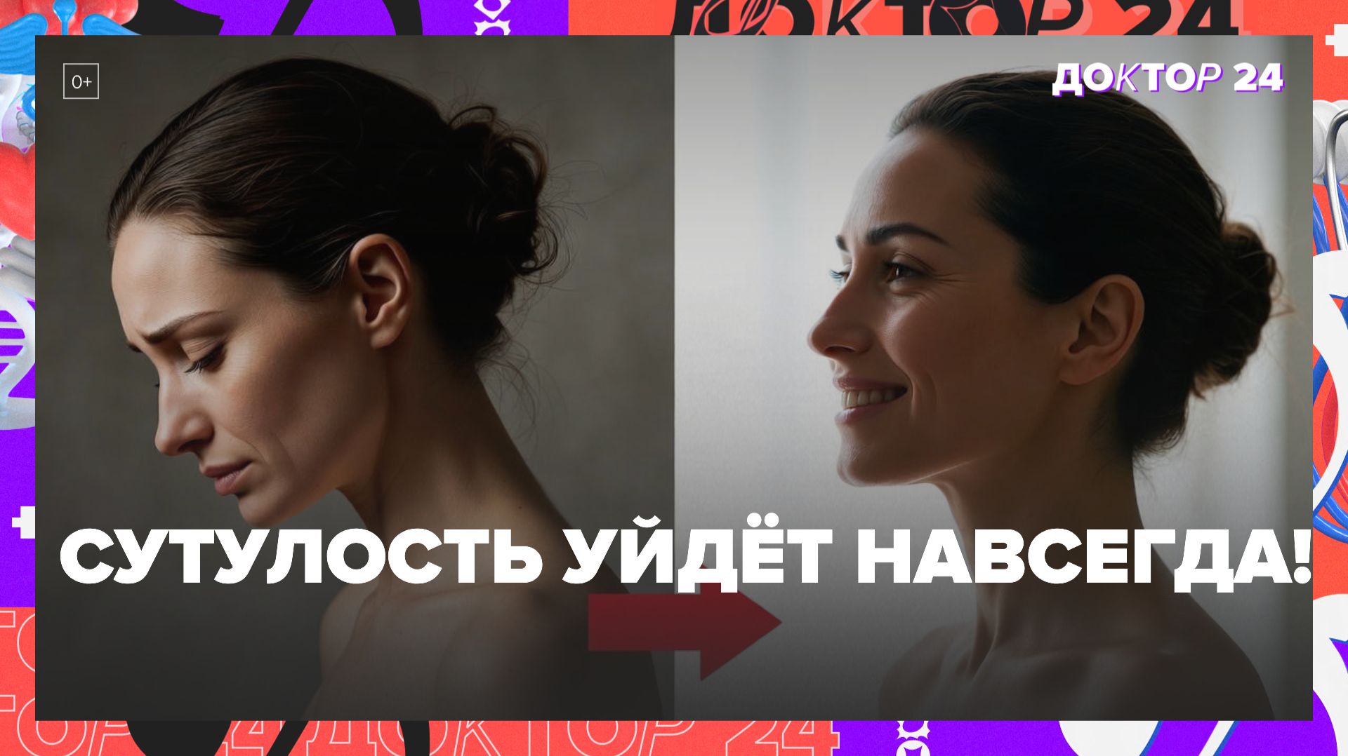 КАК ИСПРАВИТЬ СИЛЬНУЮ СУТУЛОСТЬ И ВЫПРЯМИТЬ СПИНУ НАВСЕГДА? | Доктор 24