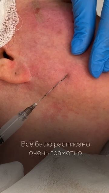 Моя история омоложения у врача-косметолога Сёмовой Александры Михайловны 🙌🏼✨