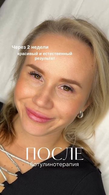 Как стереть морщины с лица?  🩷