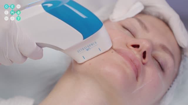 SMAS лифтинг лица на аппарате Ultraformer MPT в клинике инновационной косметологии GEN87 Москва