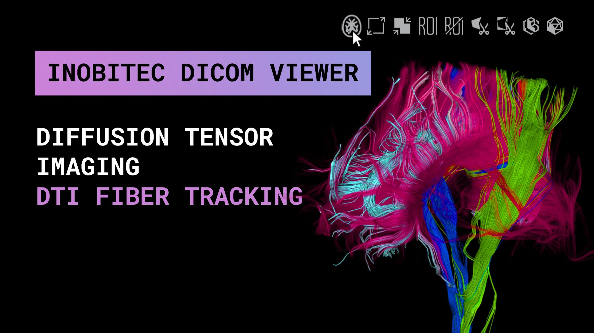 Режим просмотра DTI в Inobitec DICOM Viewer Pro