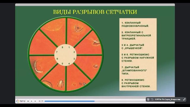 Офтальмология. Лекция №9. Патология сетчатой оболочки