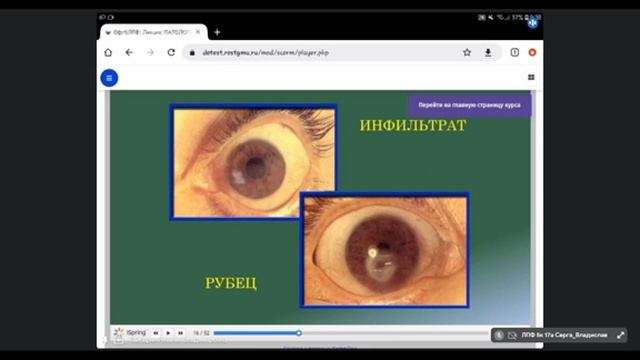 Офтальмология. Лекция №5. Патология фиброзной оболочки