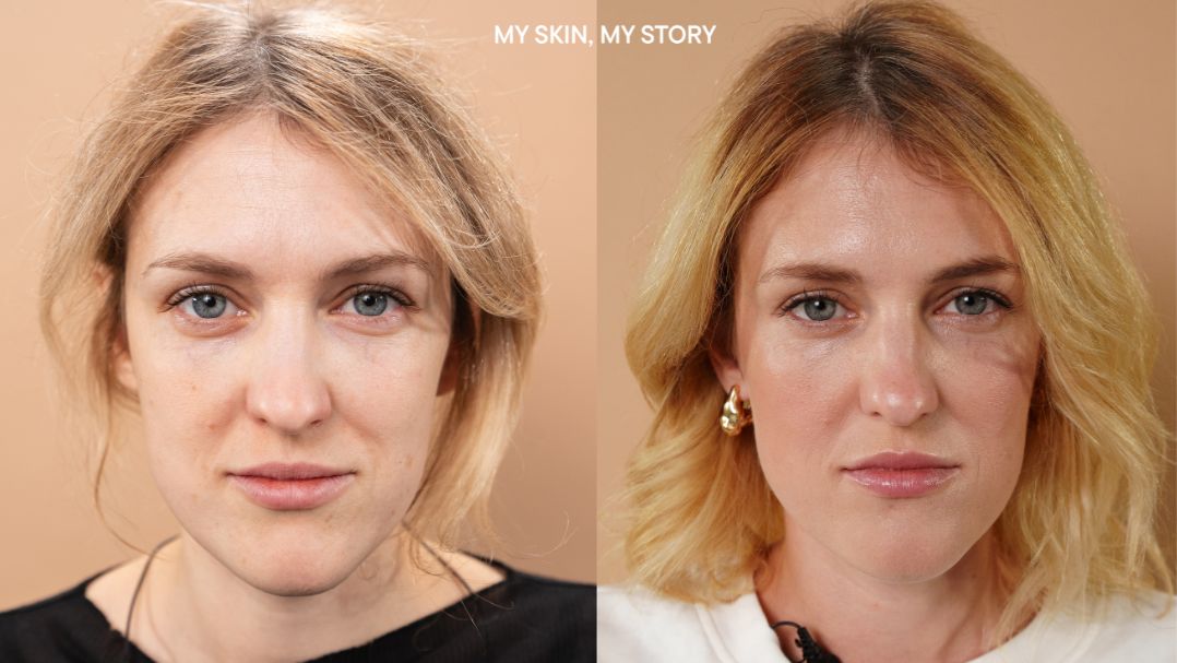 BABOR_MY SKIN, MY STORY: что делать, если кожа сухая, чувствительная и теряет тонус
