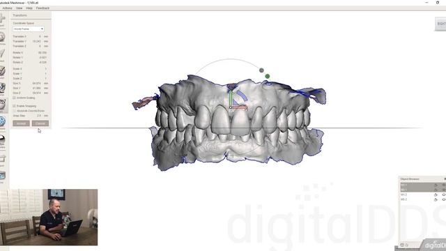 DigitalDDS - Meshmixer - Basics_29