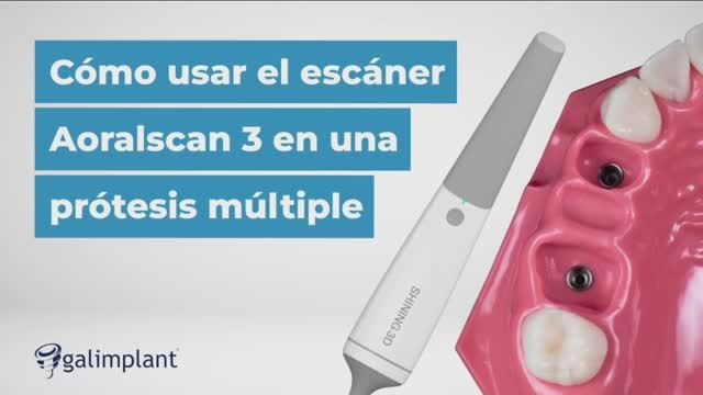 Стоматологический интраоральный сканер Aoralscan 3 от SHINING3D