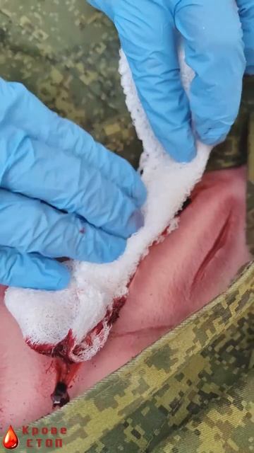 Липкое накладное ранение СурвМед ФальшРана мод.Sili “Осколочные рассечения”