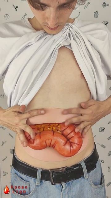 Липкое накладное ранение СурвМед ФальшРана мод.Sili “Выпадение толстой кишки”