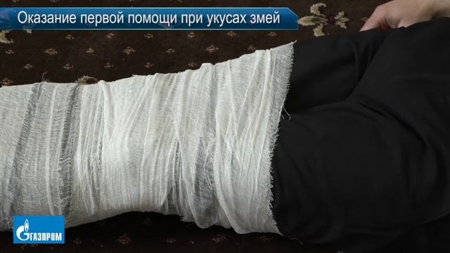 13. Оказание первой помощи при укусах змей и насекомых