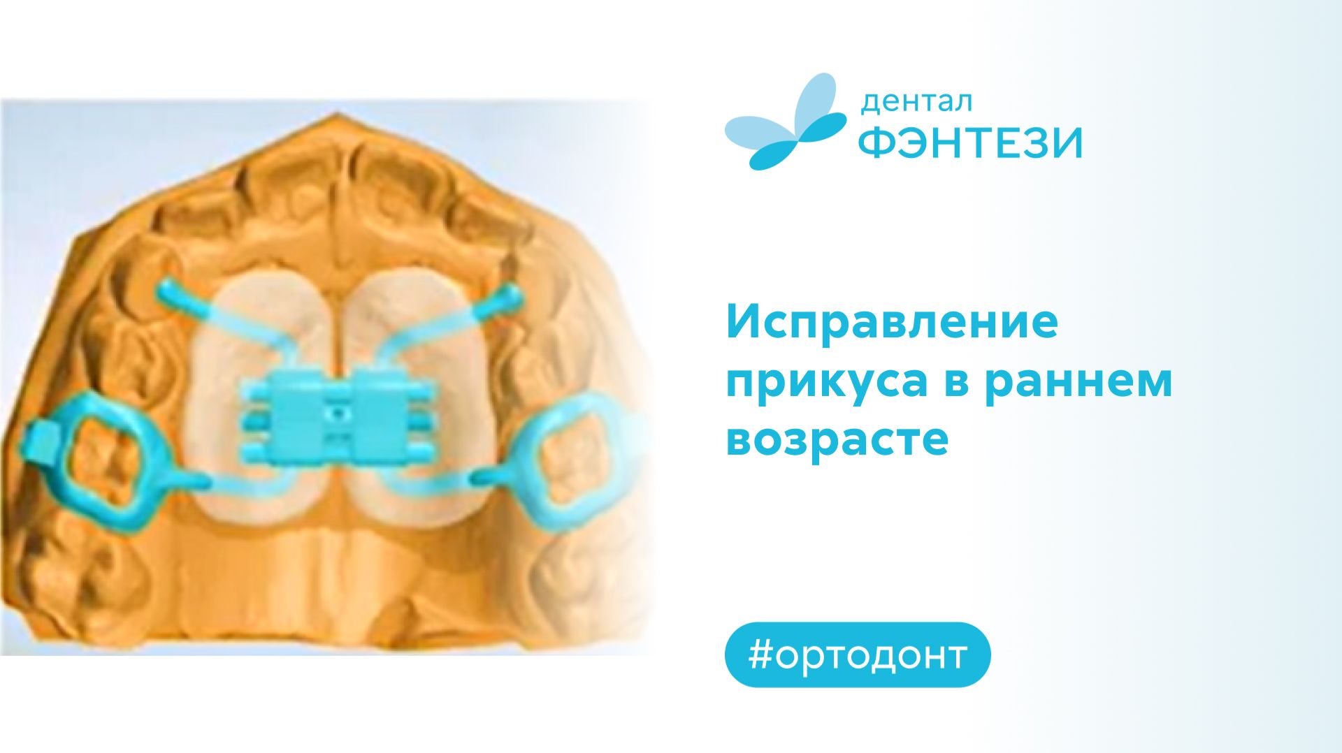 Ортодонтия у детей: исправление прикуса в раннем возрасте