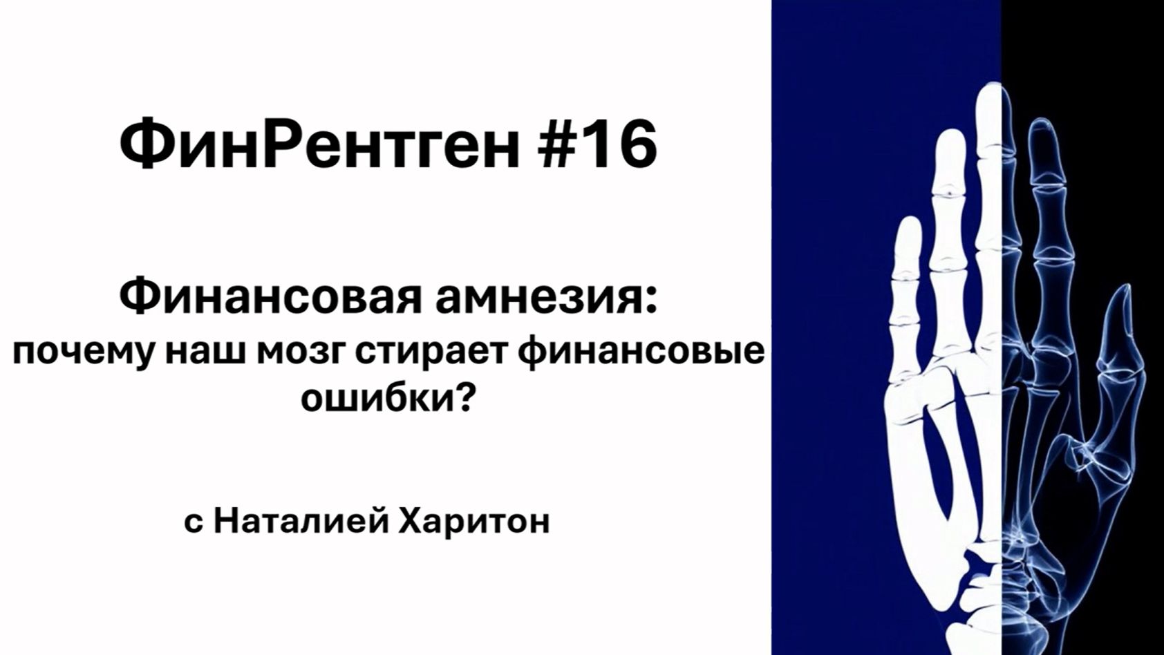 ФинРентген#16 Финансовая амнезия
