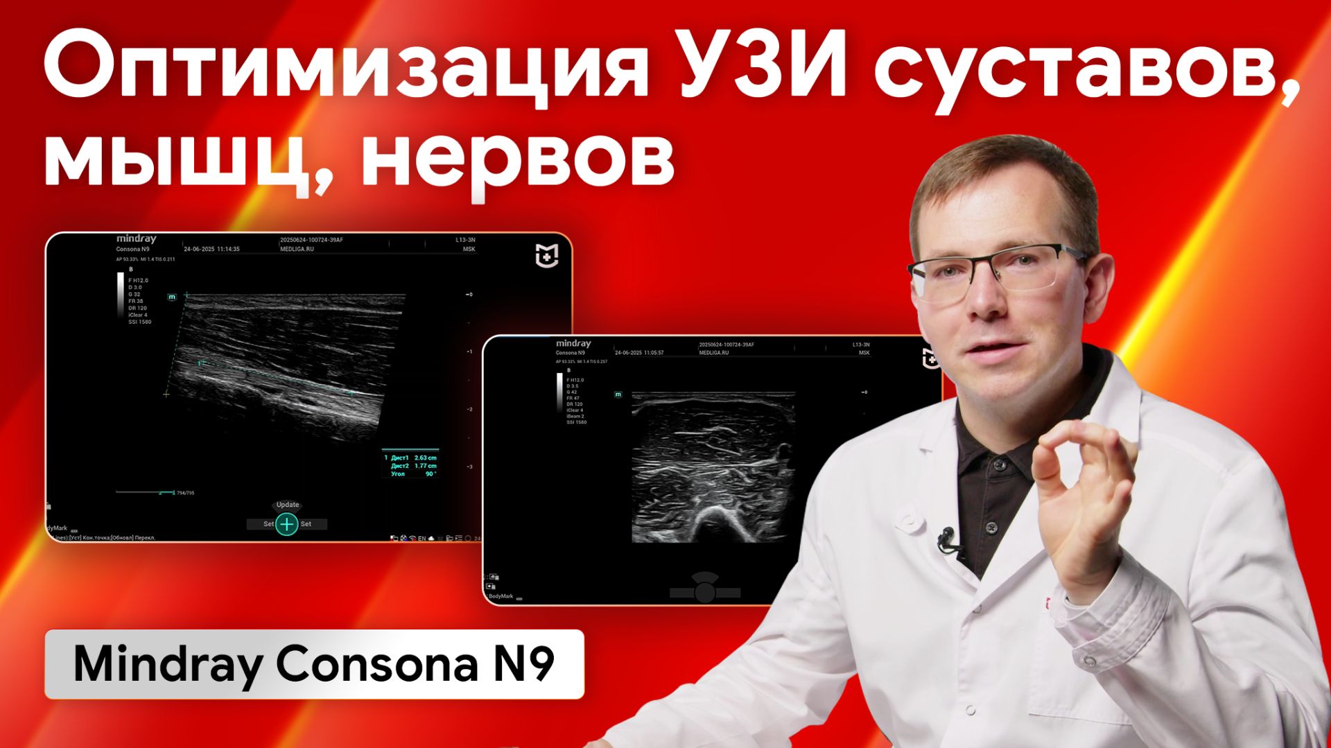Настройка изображения на Mindray Consona N9: УЗИ суставов, мышц, нервов