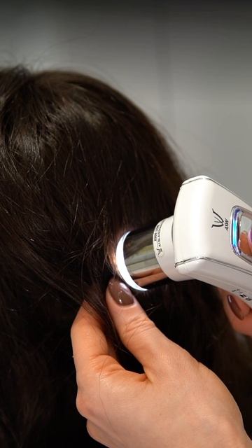 Отзыв врача-косметолога о результатах пациентки после Regenera Activ.