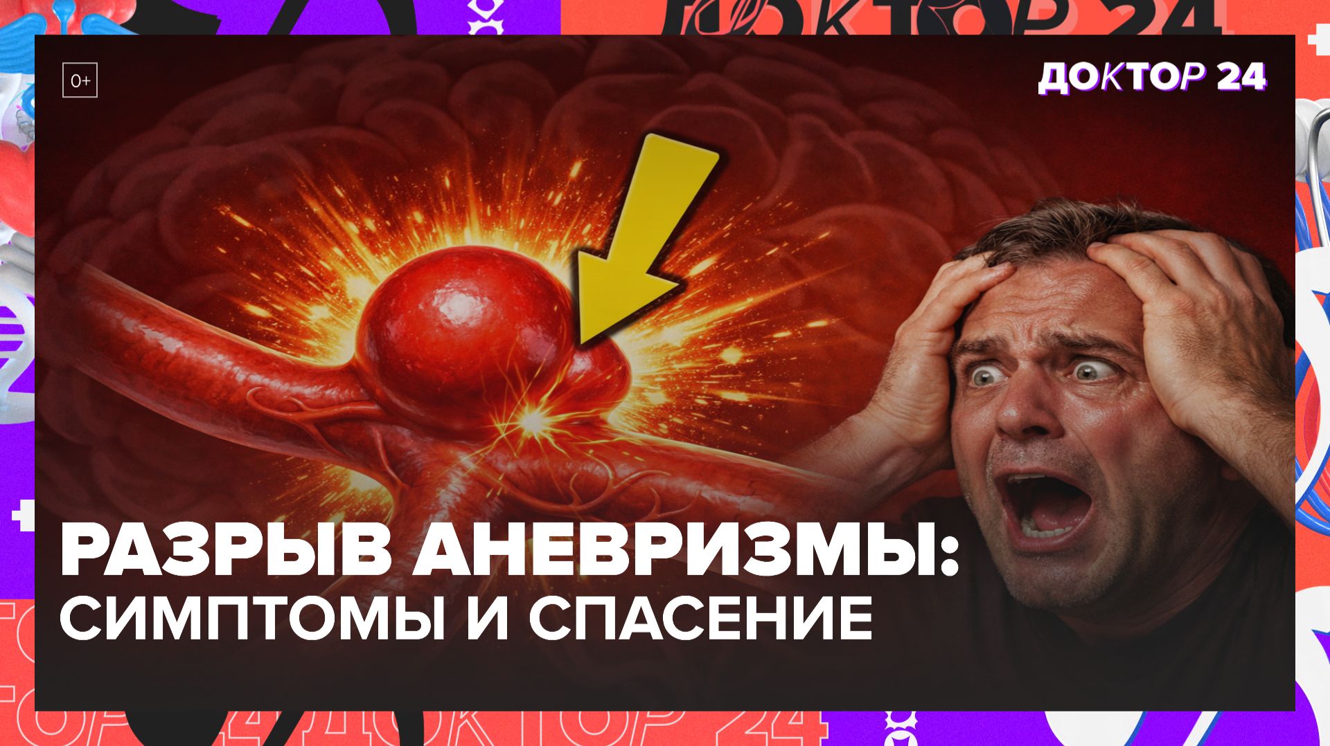 АНЕВРИЗМА ГОЛОВНОГО МОЗГА: БОМБА В ГОЛОВЕ? | Доктор 24