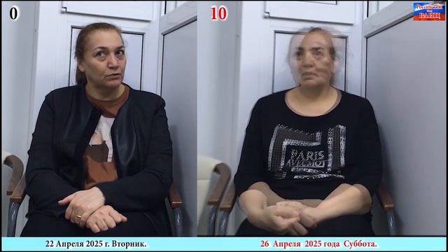 АНОНС к ВИДЕО № 1270 Изменения внешности при лечении Боли в Суставах, и регулярном применении RANC.