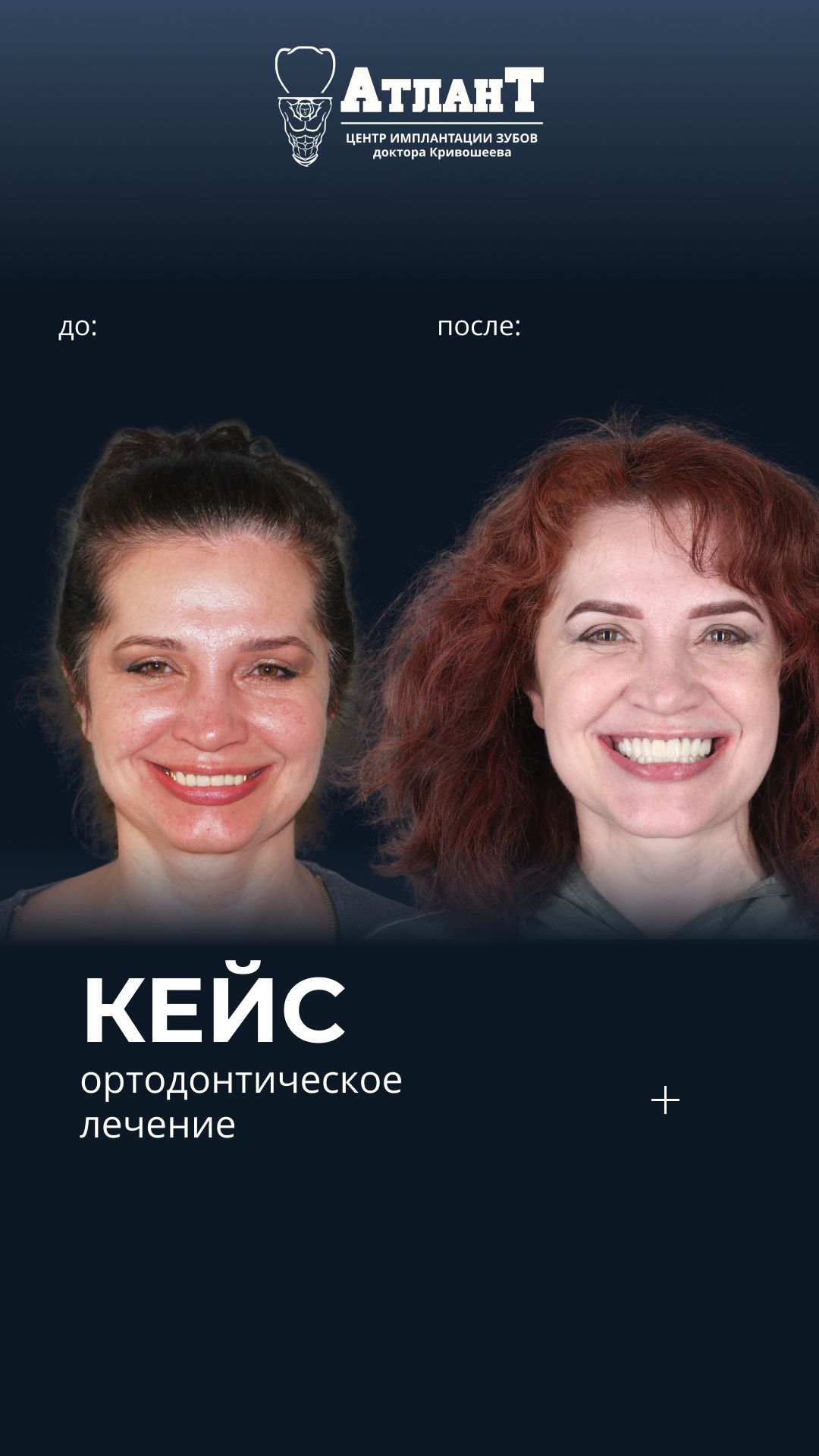 Анти эйдж эффект в стоматологии #shorts