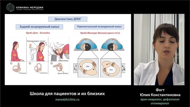 Доброкачественное пароксизмальное позиционное головокружение (ДППГ)