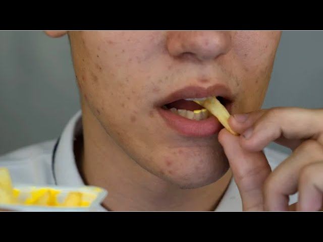 АКНЕ: диета, минералы, витамины