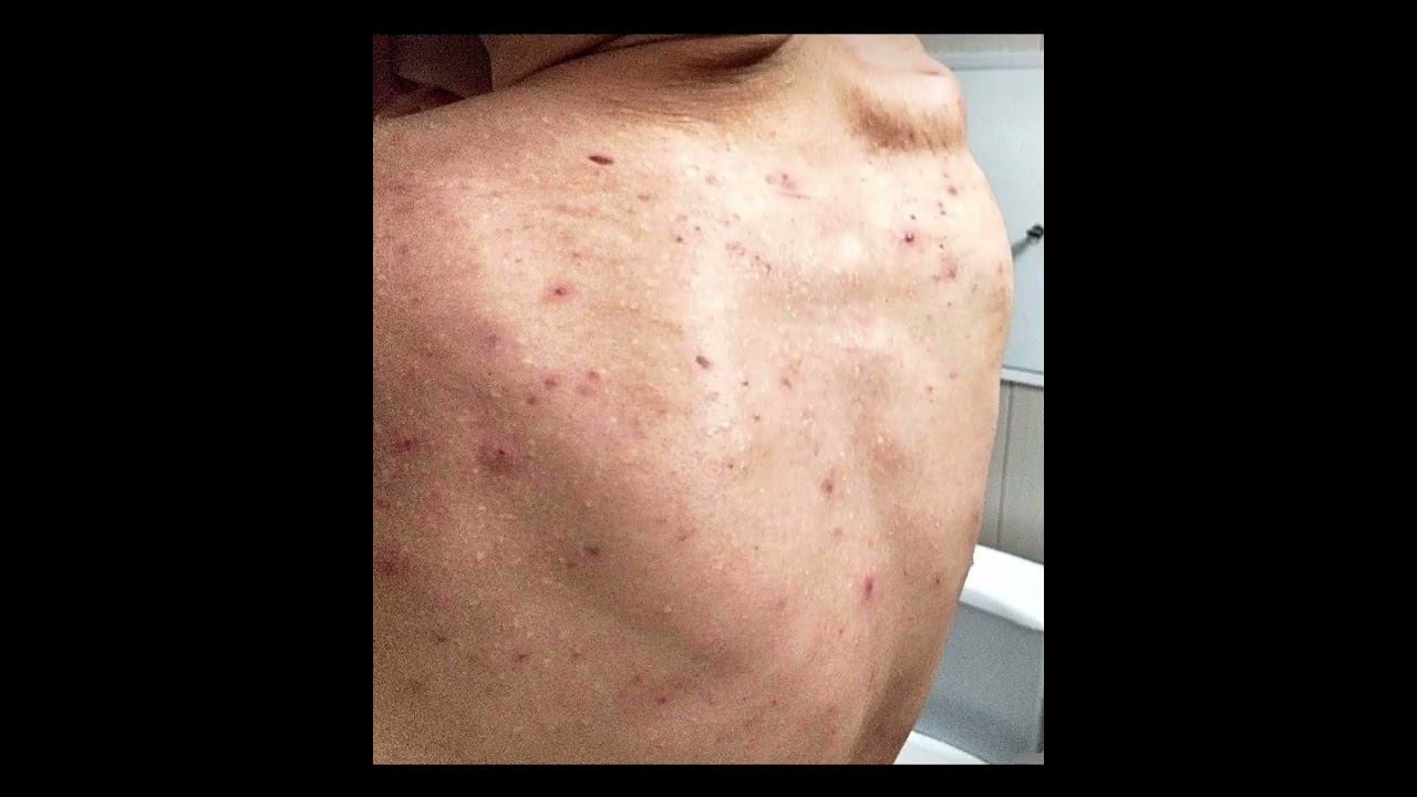 ДО и ПОСЛЕ лечения у доктора Юдиной М.М.