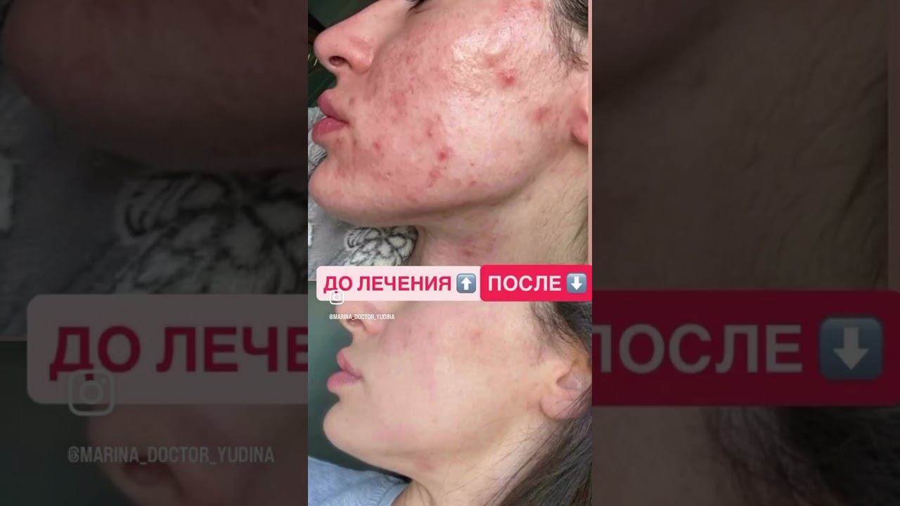 Результаты на Курсе у доктора Юдиной М.М.