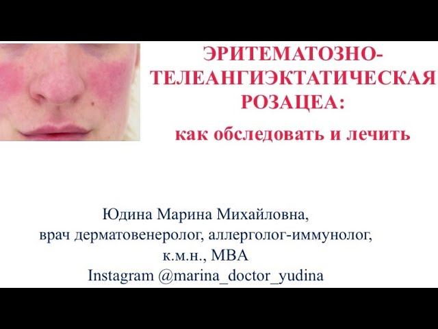 ЭРИТЕМАТОЗНО-ТЕЛЕАНГИЭКТАТИЧЕСКАЯ РОЗАЦЕА: как обследовать и лечить(видео-лекция 70 минут)