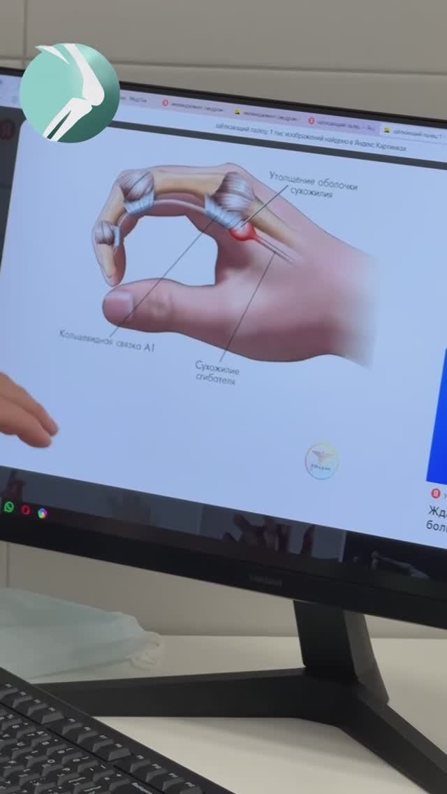 Боли в суставах кисти, блокада или хирургия? ЛД Медицина