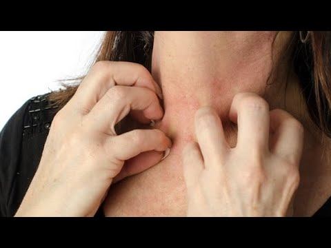 ХРОНИЧЕСКИЙ ЗУД: что обследовать и как лечить