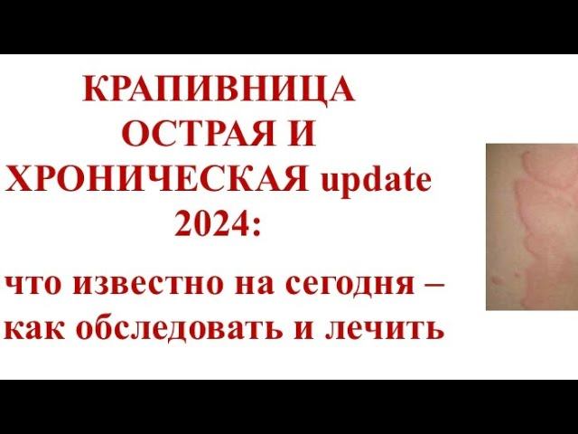 КРАПИВНИЦА