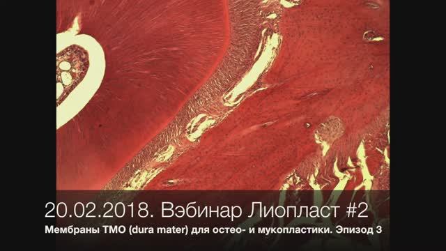 Использование ТМО (dura ma-ter) как мембраны и мукоплас-тического материала. Часть 3