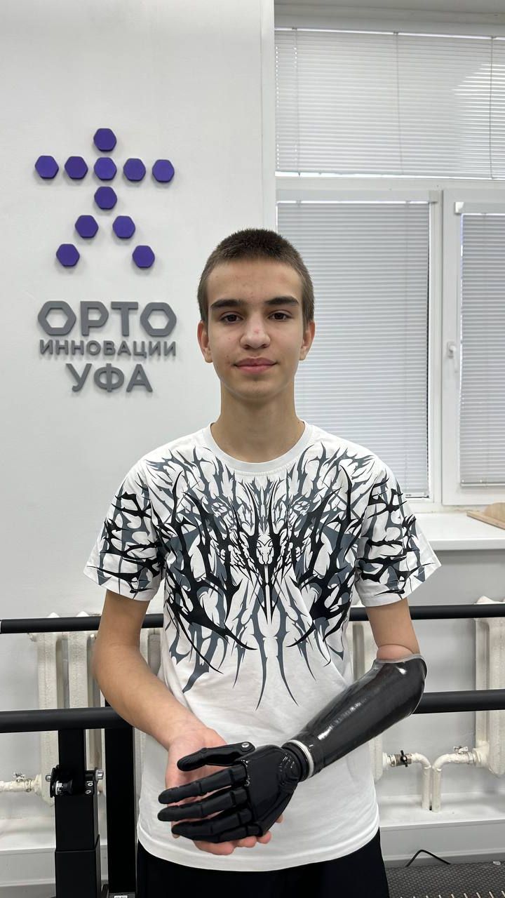 Ильяс получил активный протез руки
