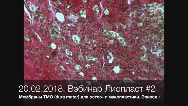 Использование ТМО (dura ma-ter) как мембраны и мукоплас-тического материала. Часть 1