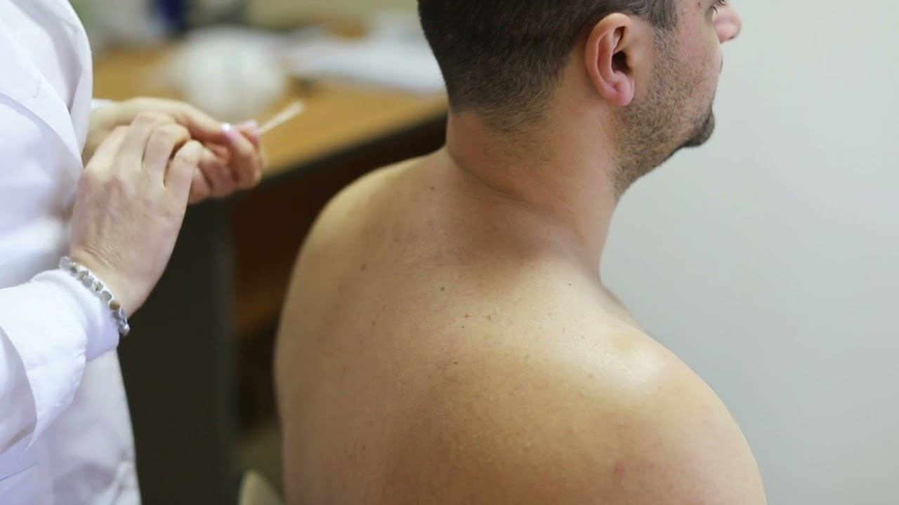 иглорефлексотерапия