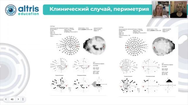 Автоматическая статическая периметрия при глаукоме
