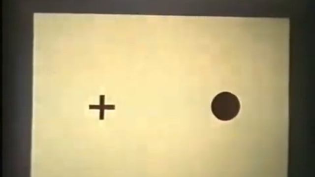 Периферическое зрение, поле зрения, скотомы, ангиоскотома © Peripheral vision. Academician M.Krasnov