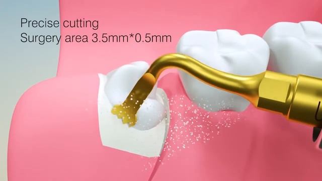 Пьезохирургический ультразвуковой аппарат Surgery-X