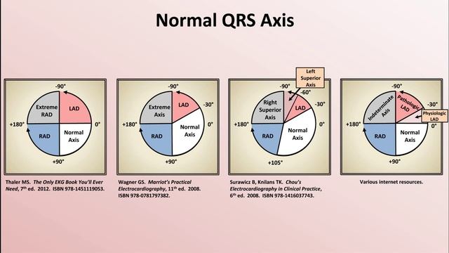 05 Intro to EKG Interpretation - Rate and Axis  Eric Strong