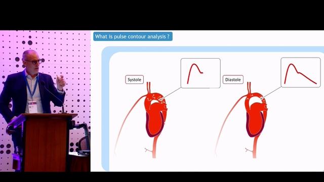 ESICM PHYSIOL 6.6.25(2)Arterial pressure curve and pulse based CO monitoring - Monnet X.